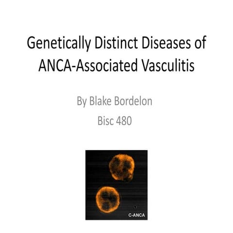 Genetically Distinct differences of ANCA-Associated Vasculitis Disorders | PPTX