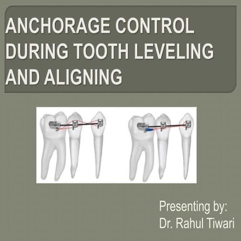 Anchorage control during tooth leveling and aligning | PPTX
