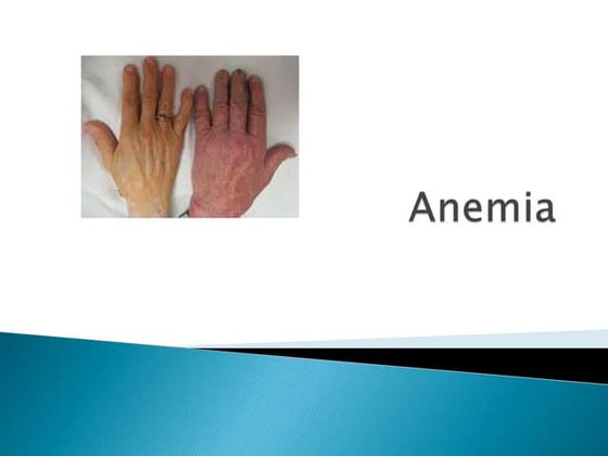 Anaemia- Classification, types, causes, pathophysiology, etiology ...