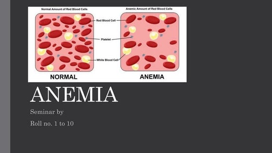 Types of anemia | PPT