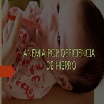 Anemia por deficiencia de hierro pediatrica | PPTX