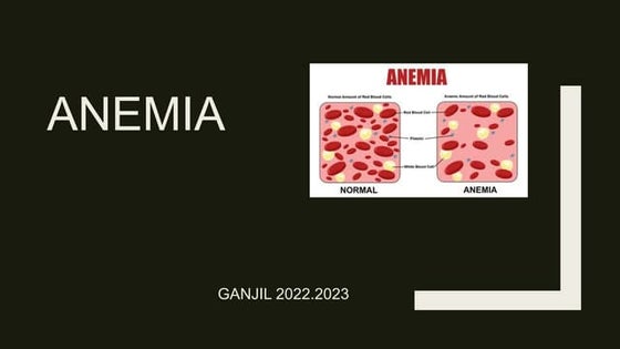 Anemia hemolitik | PPTX