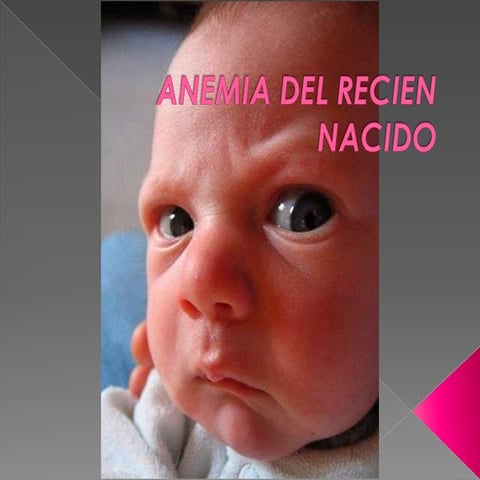 Anemia del recien nacido | PPTX