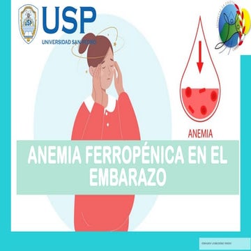 ANEMIA FERROPÉNICA EN EL EMBARAZO.pptx F. | PPTX
