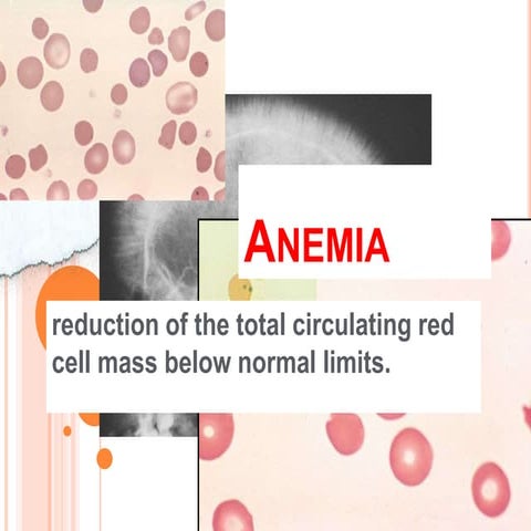 Anemia overview | PPTX