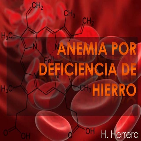 Anemia por deficiencia de hierro | PDF