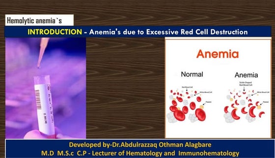 Paroxysmal nocturnal hemoglobinuria (PNH) | PPT