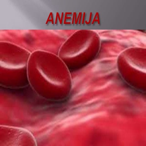 Anemija violeta klisaric | PPTX