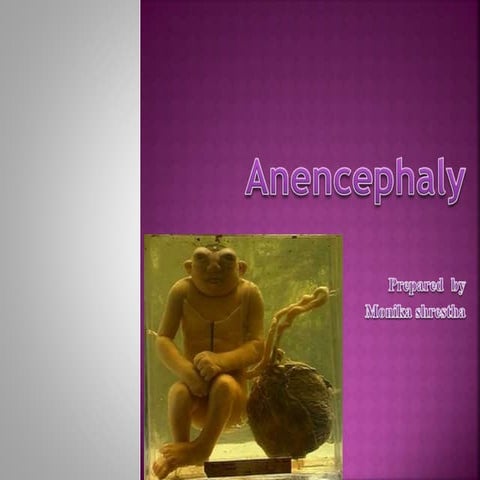 anencephaly.pptx