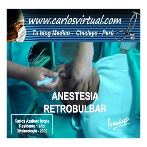 Anestesia retrobulbar | PDF