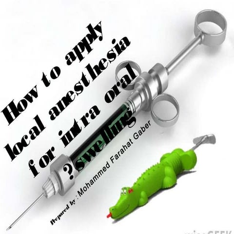 Maxillary Local Anesthesia | PPT