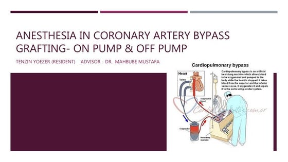 Central Venous Catheterization without Ultrasound guidance | PPT