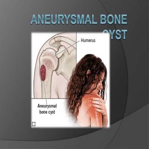 Aneurysmal bone cyst.pptx