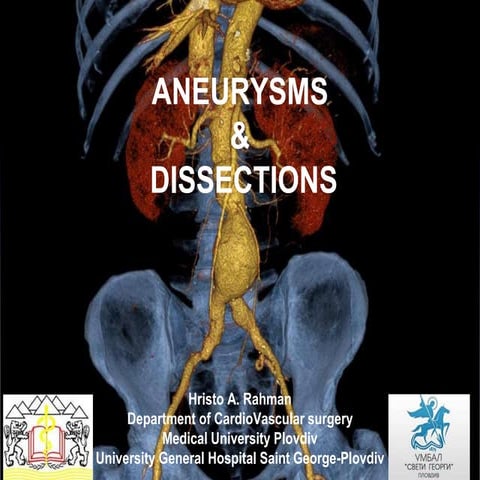 Aneurysms & dissections | PPTX