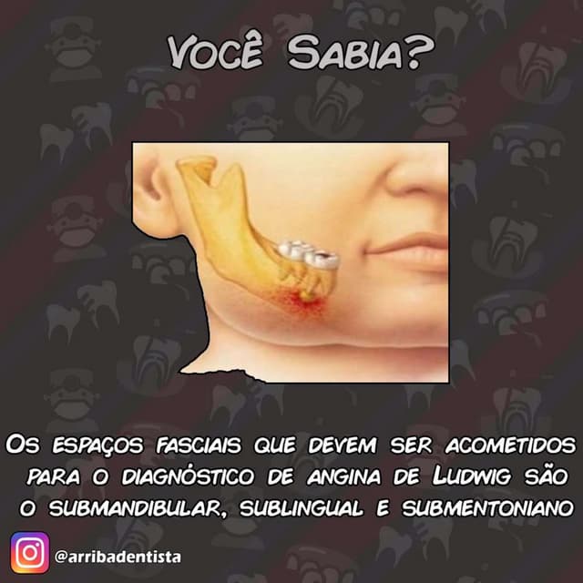 Arco Tipo I e Tipo II de Baume - Resumo Concurso Público de Odontologia.pdf