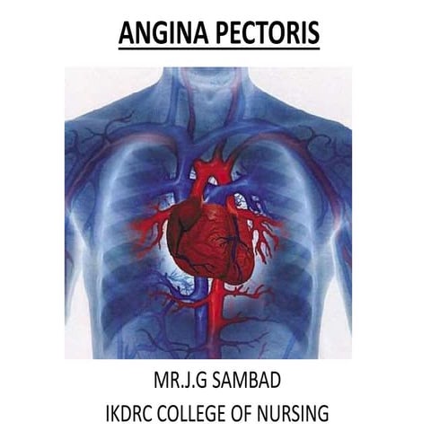 Angina pectoris | PPTX | Heart and Cardiovascular Diseases | Diseases ...