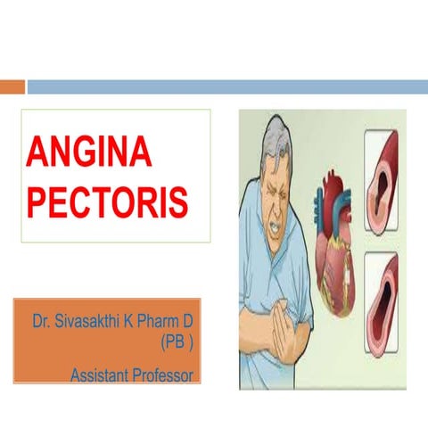 Angina pectoris | PPTX