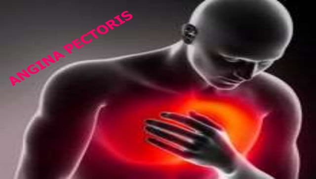 Angina pectoris | PPT