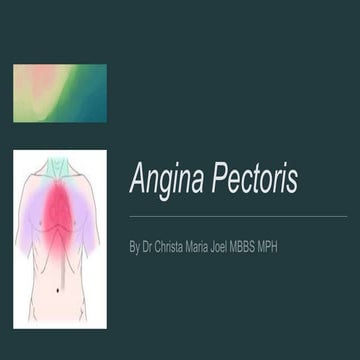 ANGINA PECTORIS | PPTX