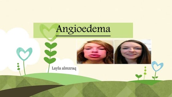 periorbital emphysema article | PDF