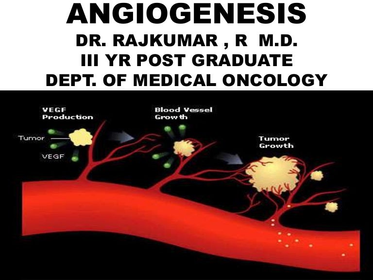 Angiogenesis presentation