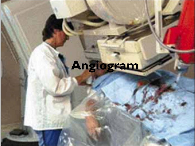 Angiogram