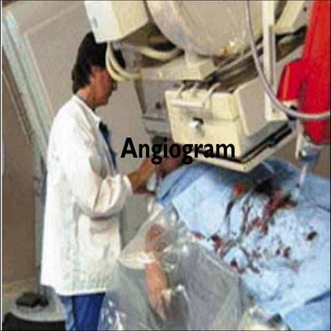 Left ventricular angiogram (1) | PPTX