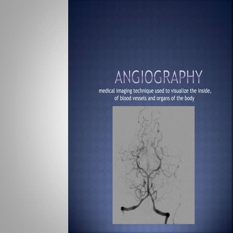 angiography-17041.pdf