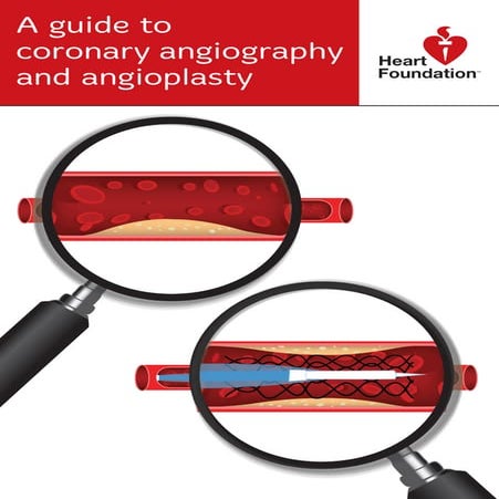 angiography-and-angioplasty-2018.pdf