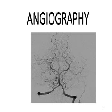 Angiography,blood vessels, recording, radiological equipment | PPTX