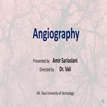 Comprehensive Overview of Angiography: X-ray Production, Imaging, and ...