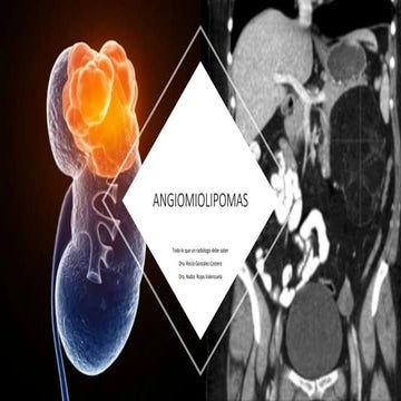 ANGIOMIOLIPOMAS NADIA ROJAS.pptx