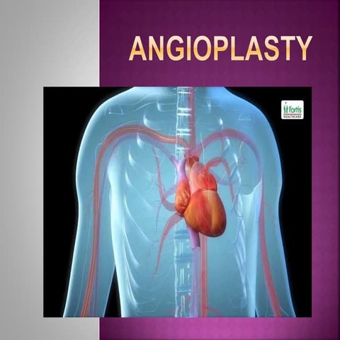 Angioplasty & Stents | PPTX