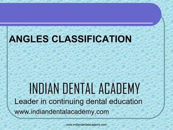 Angle’s class 1 | PPT