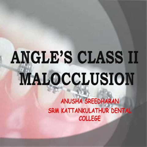 Angle’s class ii malocclusion | PPTX