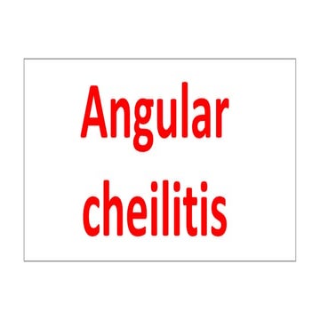 Angular chilitis | PPTX
