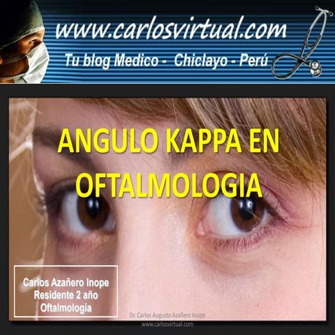 Angulo kappa en oftalmologia | PPTX