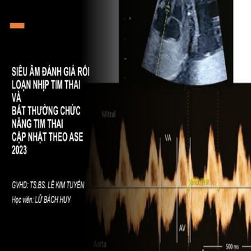 Đánh giá rối loạn nhịp tim thai và chức năng tim thai ASE 2023.pptx