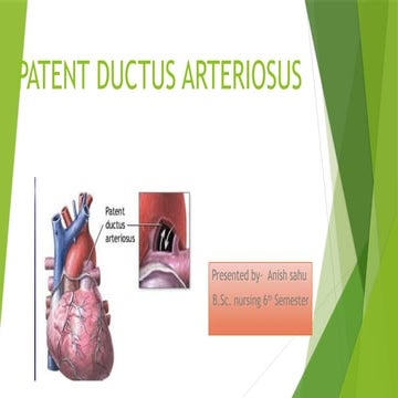 Patent ductus arteriosus child health nu | PPTX