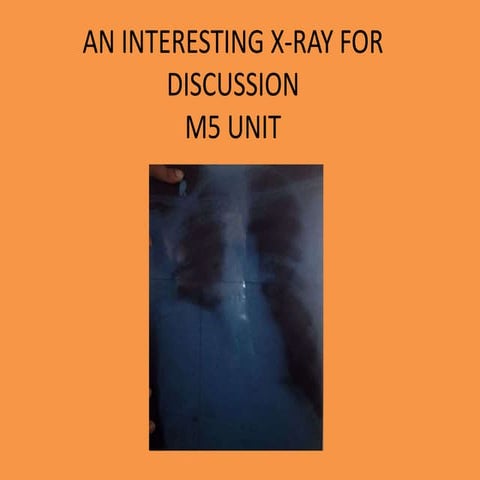 An interesting x ray for discussion | PPTX