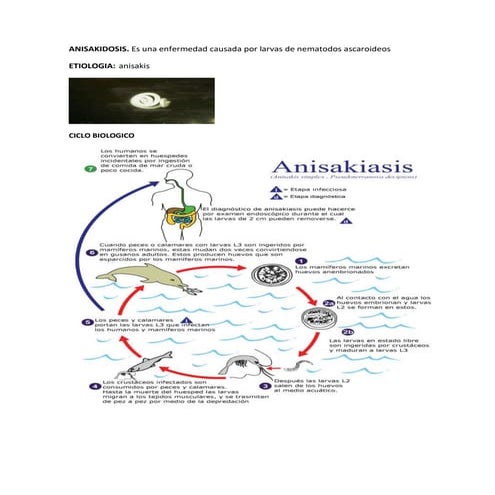 ANISAKIDOSIS 1 enfermedad anisakiasis.docx