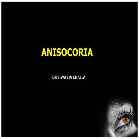 Anisocoria | PPTX