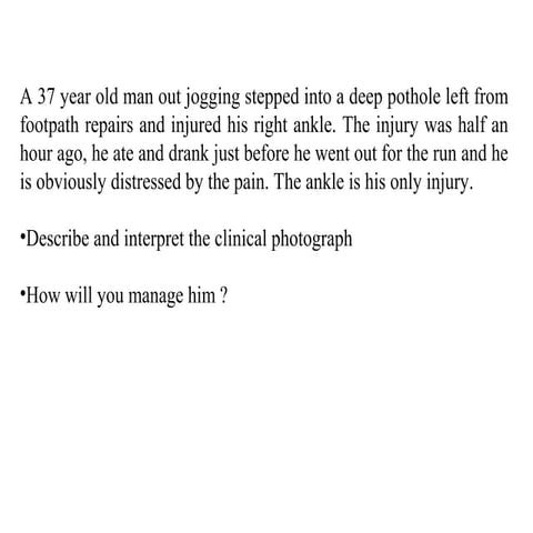 Ankle dislocation 2019 | PPT