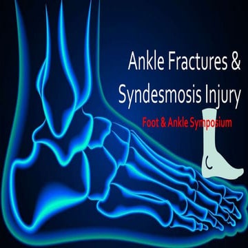 Ankle Fractures and Syndesmosis.pptx