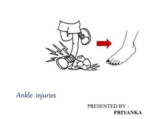Common injuries during recreation | PPT