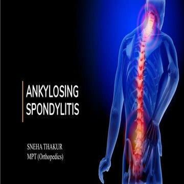 Ankylosing Spondylitis (Assessment and Physiotherapy Management) | PPT