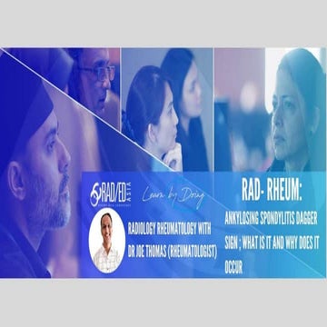 ANKYLOSING SPONDYLITIS SPINE IMAGING DAGGER SIGN RADEDASIA | PPT