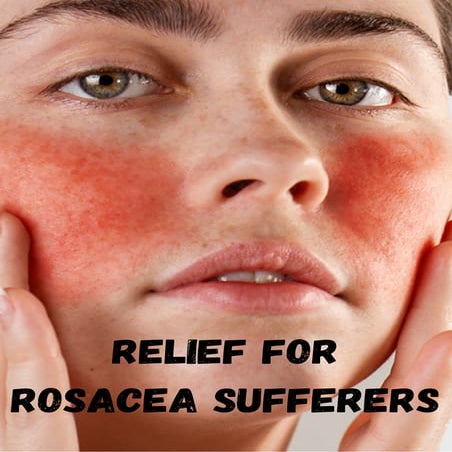 ROSACEA RELIEF SERUM | PDF