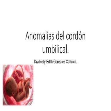 ANOMALIAS DEL CORDON UMBILICAL. GINECOLOGÍA | PPTX