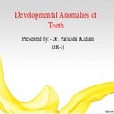 Developmental Anomalies Of Teeth | PPTX